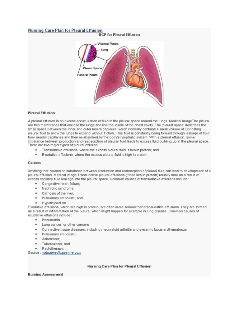 Nursing Care Plan for Pleural Effusion | PDF | Diabetes Mellitus ...