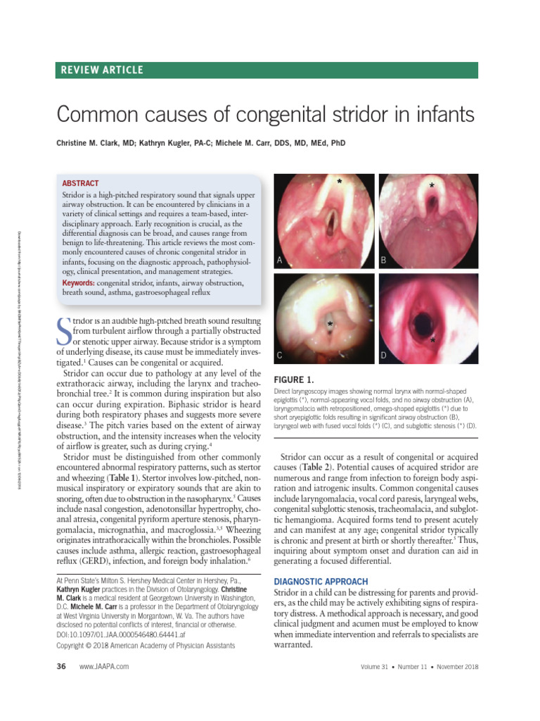 Common Causes of Congenital Stridor in Infants - 2018 | PDF