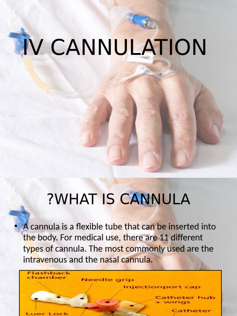 IV Cannulation | PDF
