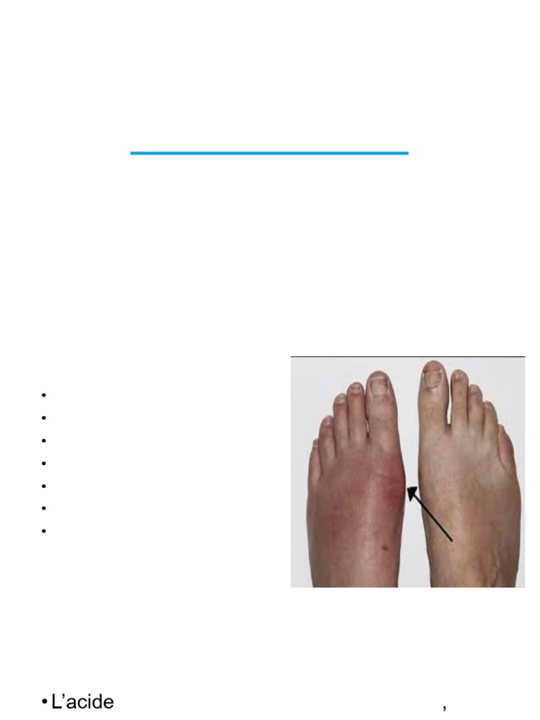 La Goutte | PDF