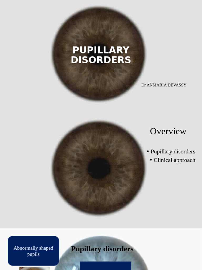 Abnormalities of Pupil | PDF