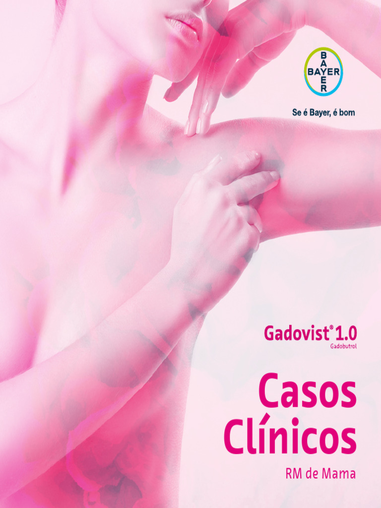 Casos Clínicos Mama Gadovist | PDF
