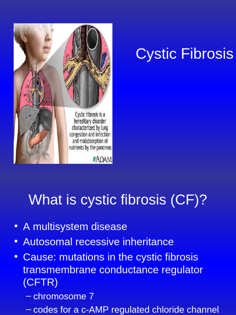 04 - Cystic Fibrosis | PDF