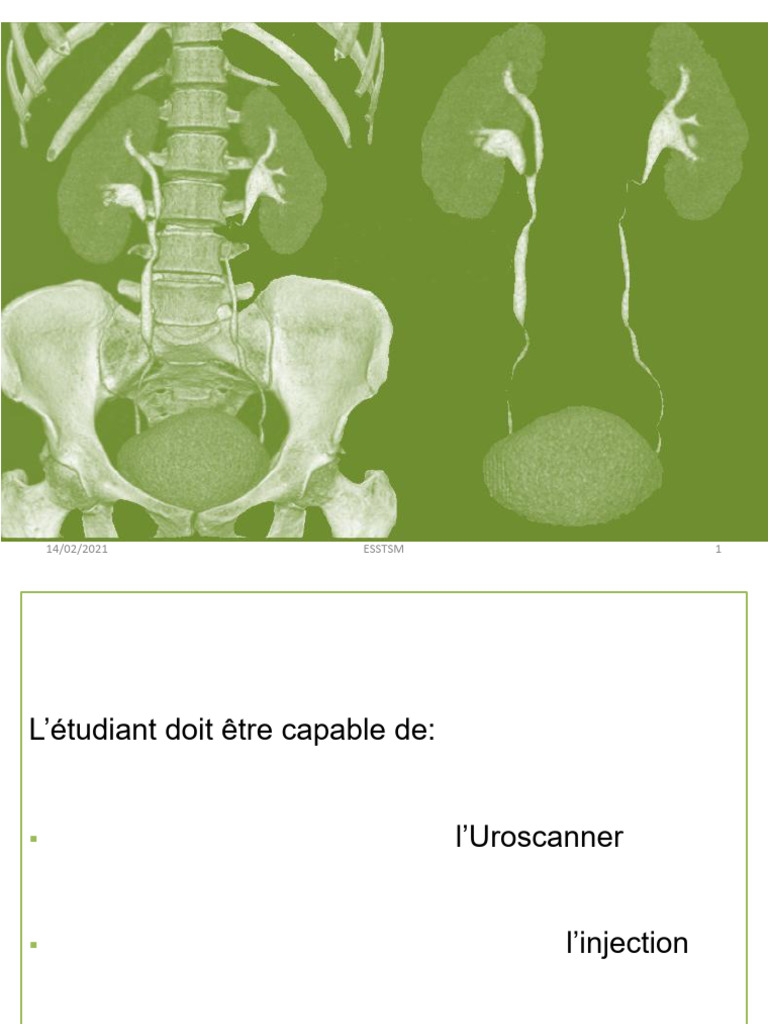 Uroscan | PDF