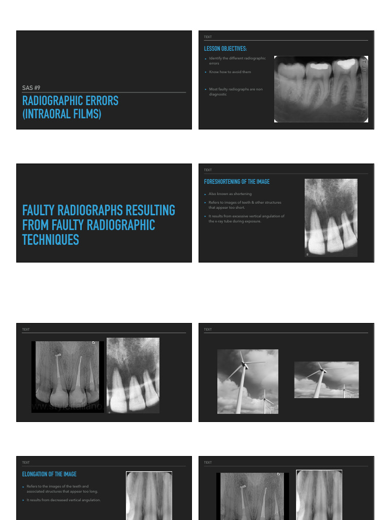 Radiographic Errors | PDF