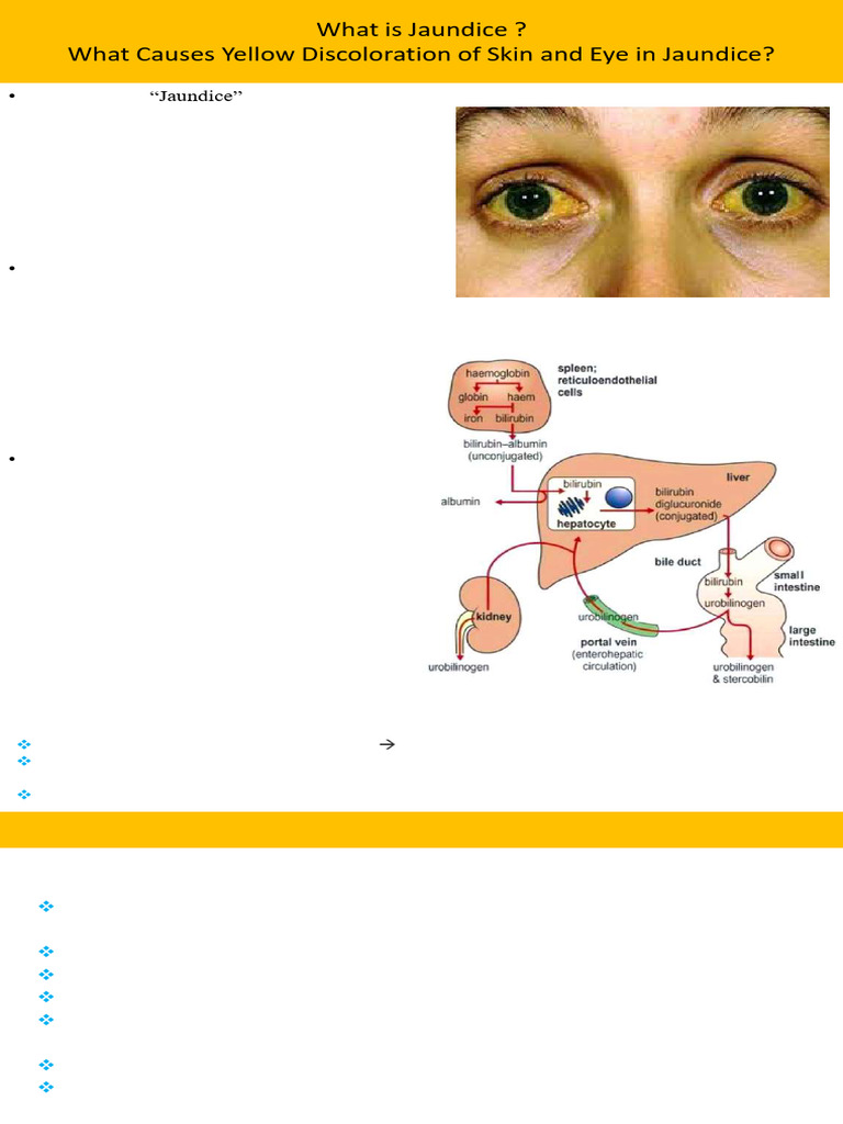 Jaundice 2 | PDF