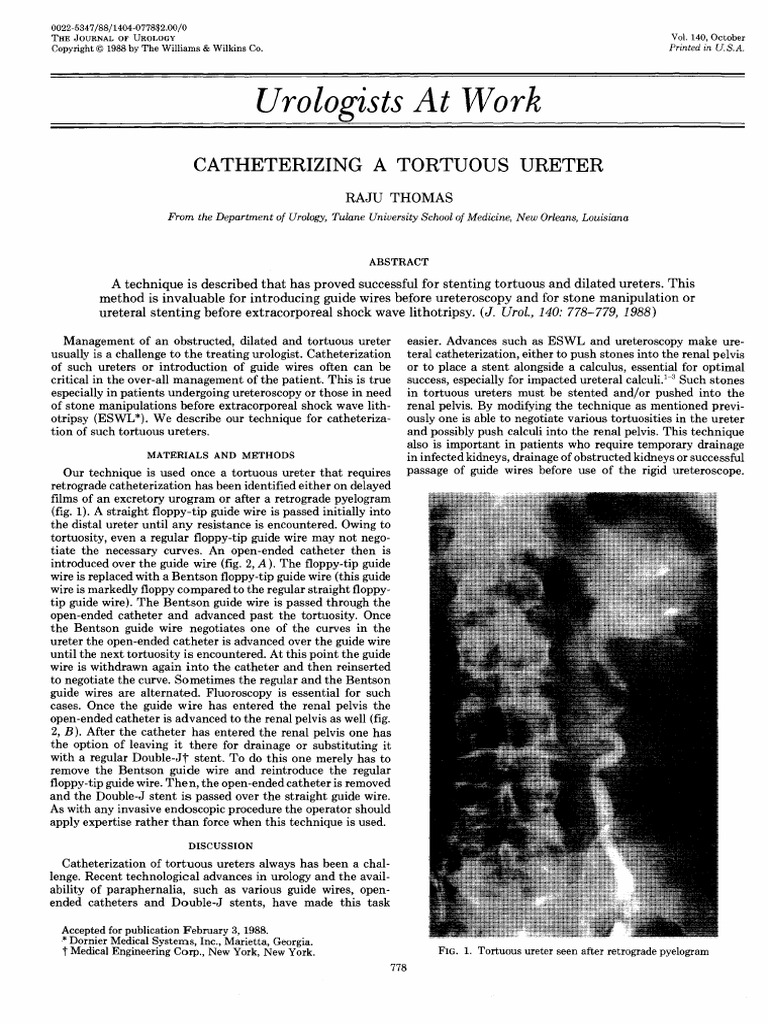 Catheterizing A Turtuous Ureter | PDF