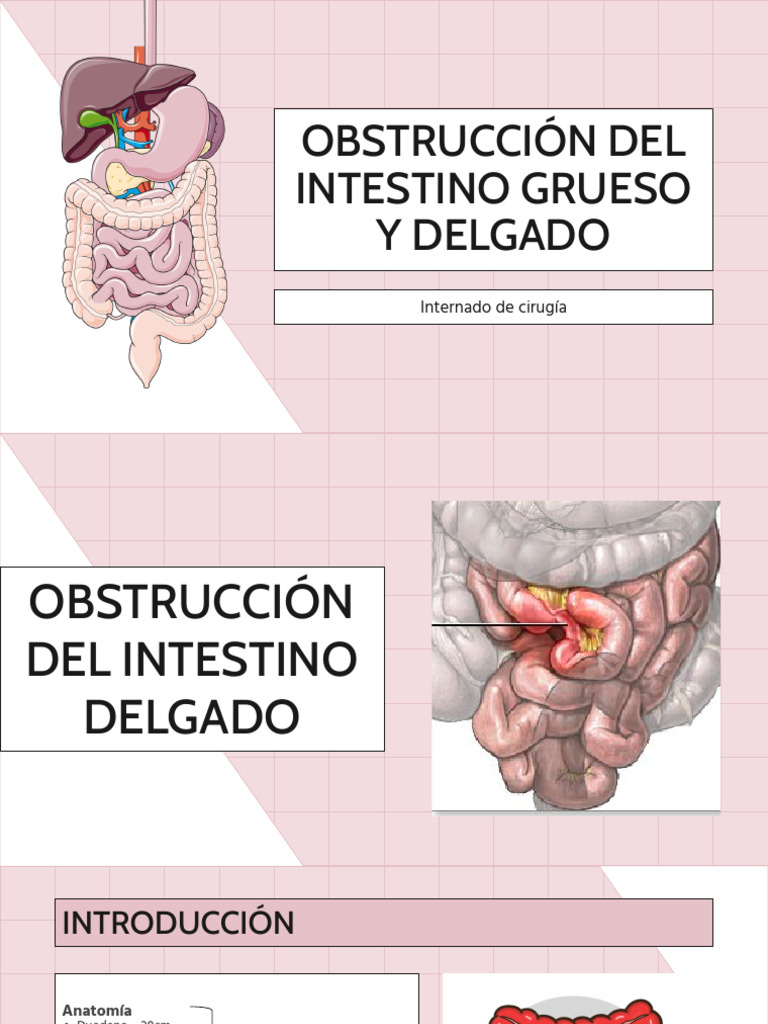 Obstruccion Del Intestino Grueso y Delgado | PDF