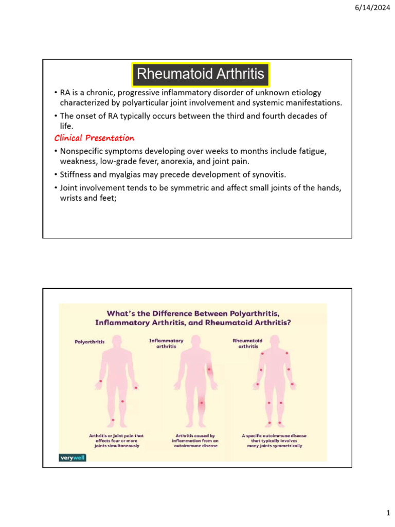 Rheumatoid Arthritis: Clinical Presentation | PDF