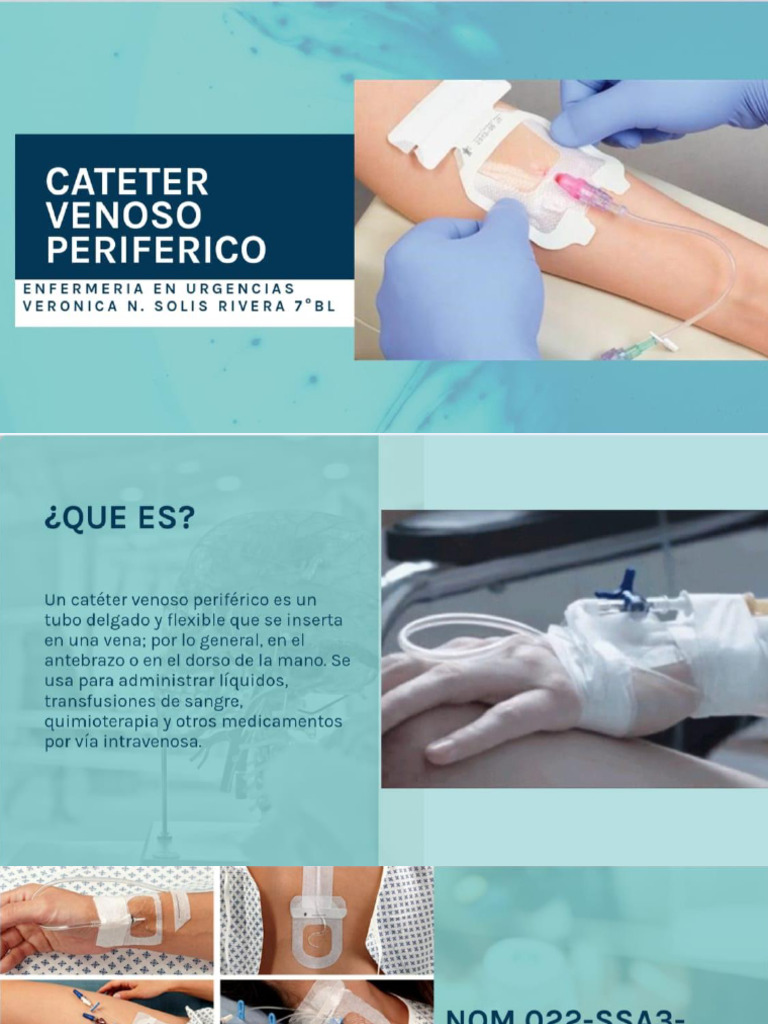 Cateter Venoso Periférico Corto | PDF