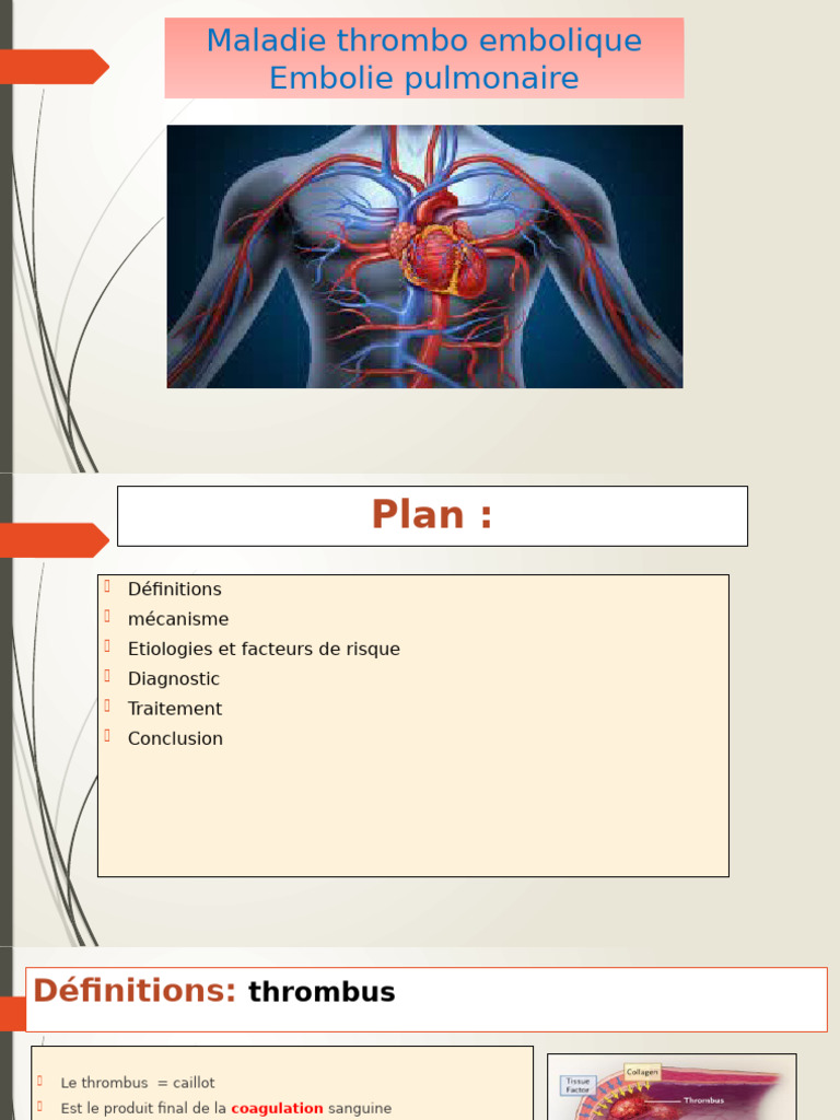 Embolie Pulmonaire | PDF | Thrombus | Médecine