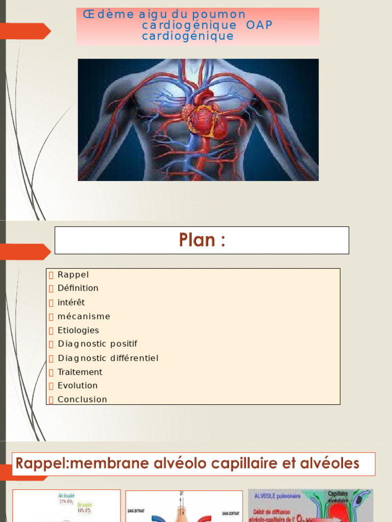OAP Cardiogénique : Diagnostic et Traitement | PDF | Infarctus du ...