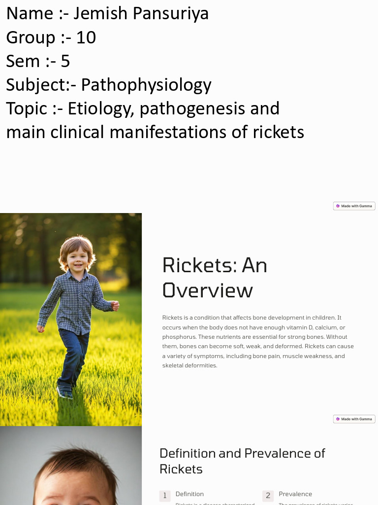 Rickets An Overview | PDF