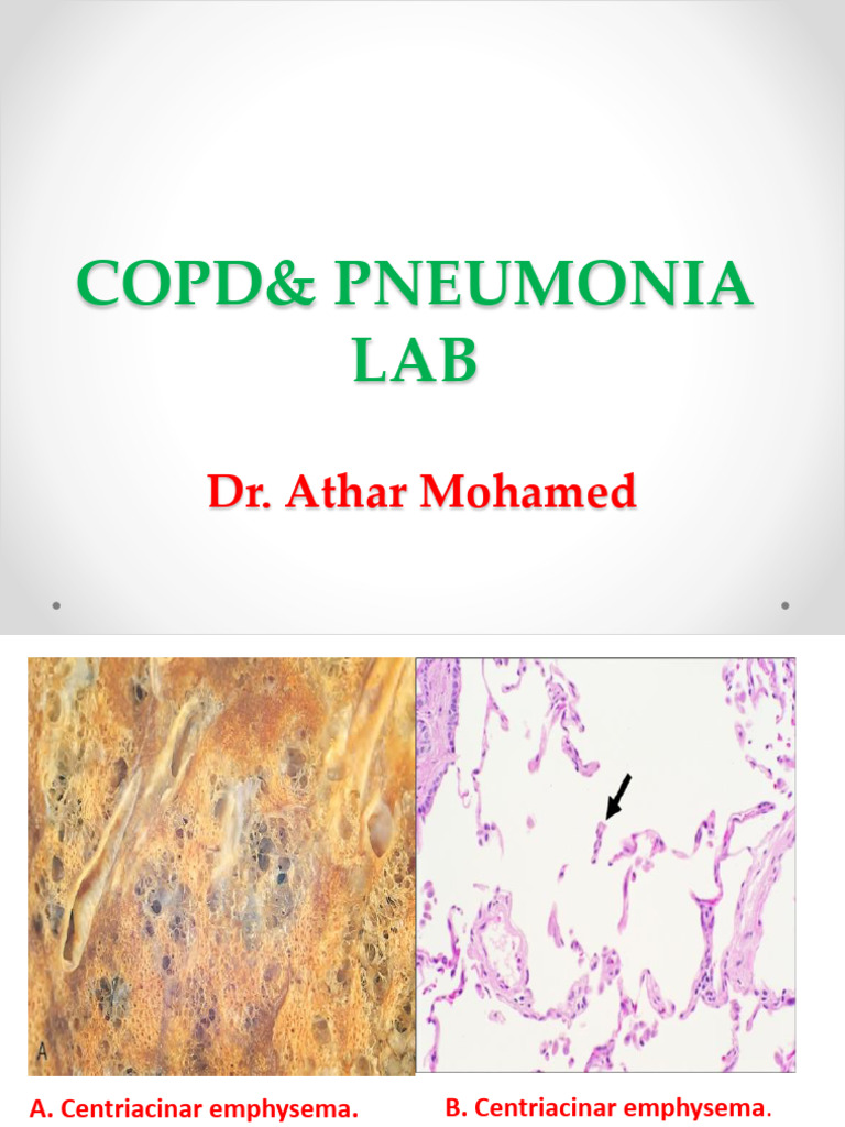 Patho Copd and Pneumonia Lab Dr. Athar | PDF