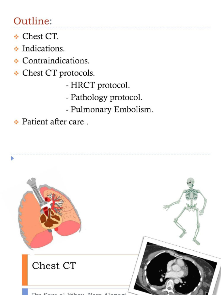 Chest CT | PDF