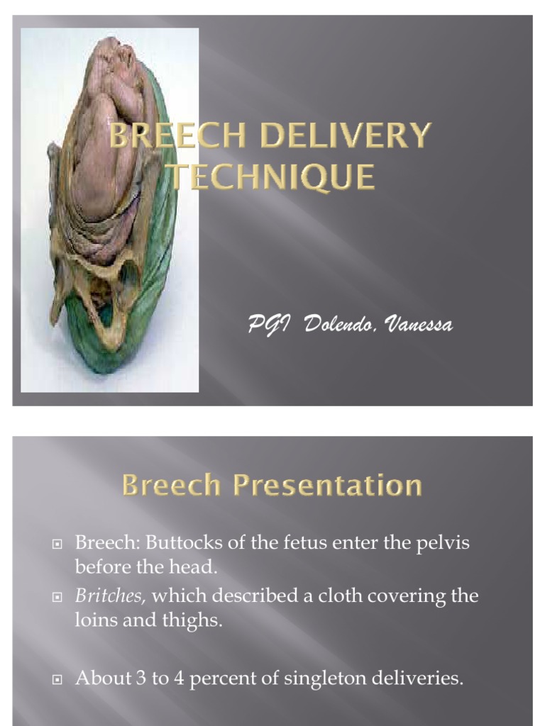 Breech Delivery Technique