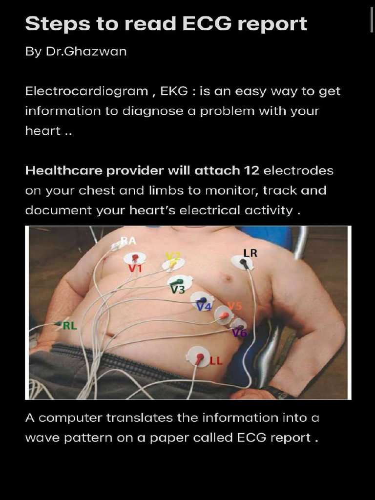 Steps To Read ECG | PDF