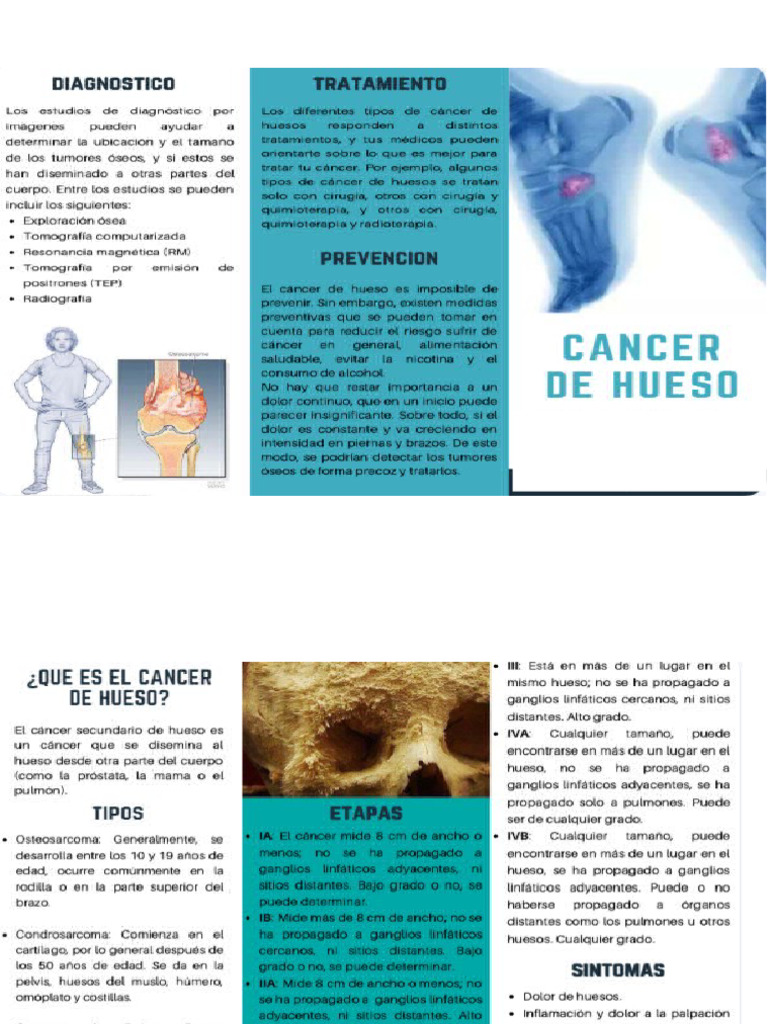 Triptico Cancer Oseo | PDF