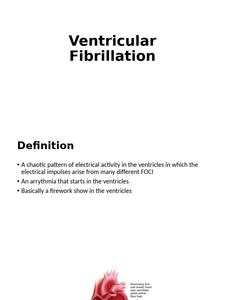 Ventricular Fibrillation | PDF