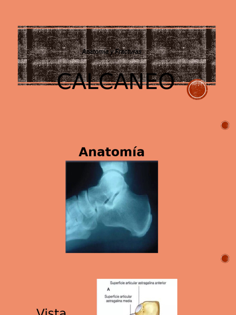 anatomica calcaneo 2 | PDF
