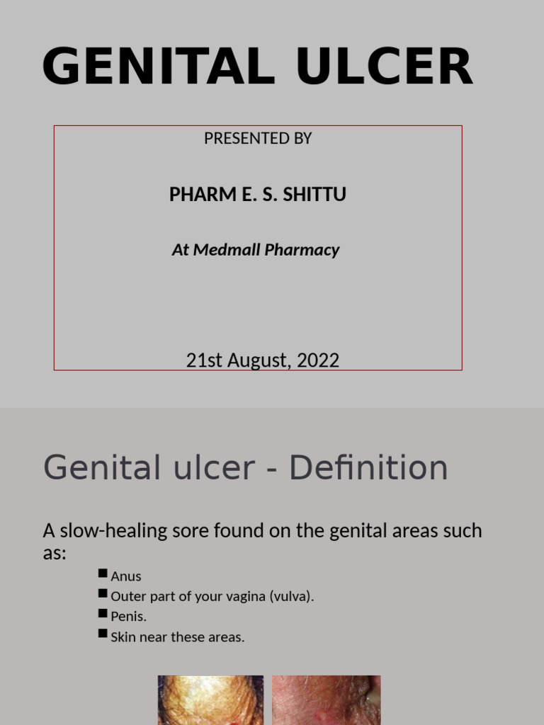 Genital Ulcer by Pharm Esther | PDF
