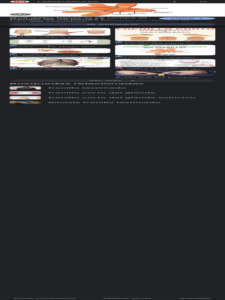 Frenillo Pene - Buscar Con Google | PDF