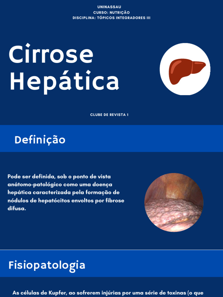 Cirrose Hepática | PDF