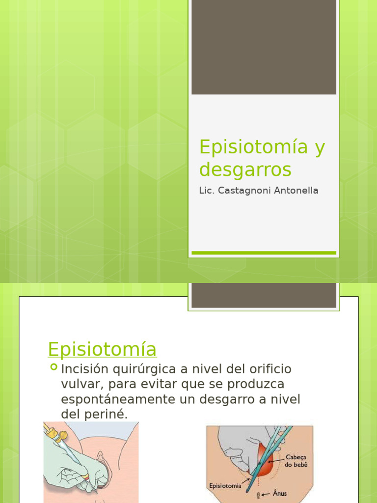 Episiotomía y Desgarros. IAR | PDF