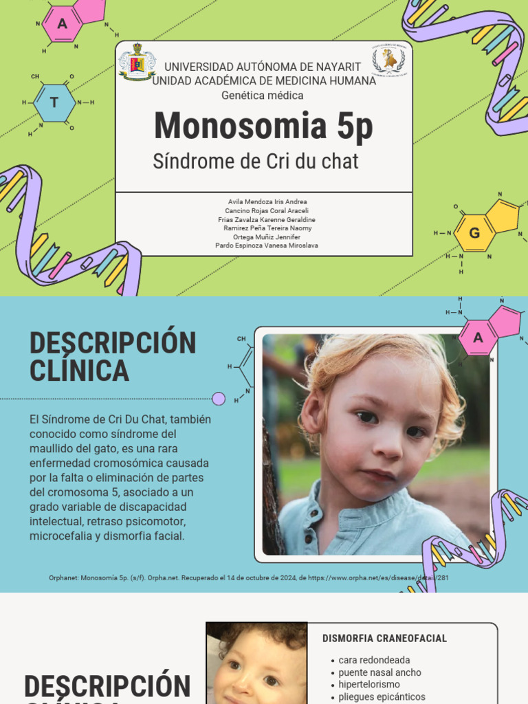 Monosomia 5p PDF | PDF