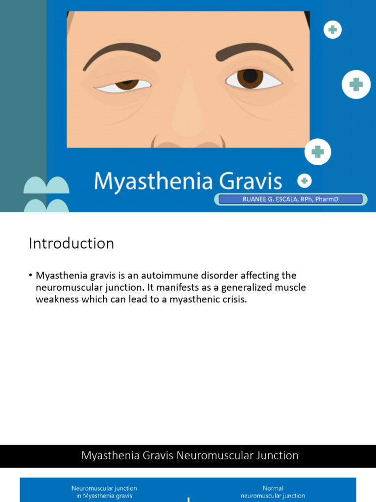 Myasthenia Gravis | PDF