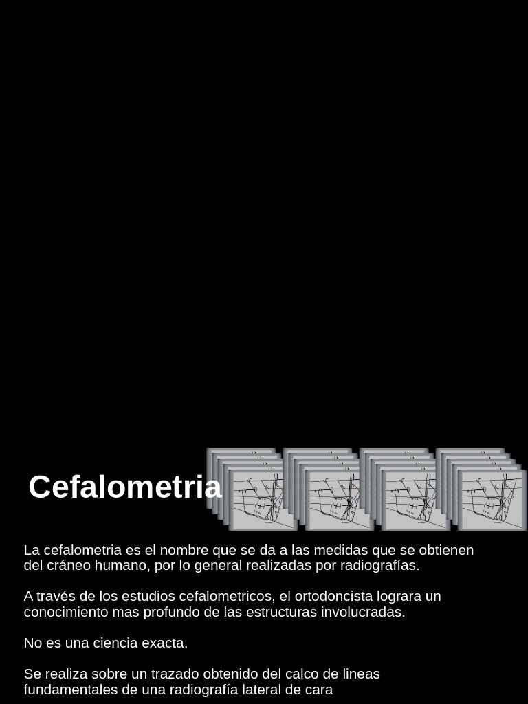 T Cefalometriasss PWP | PDF