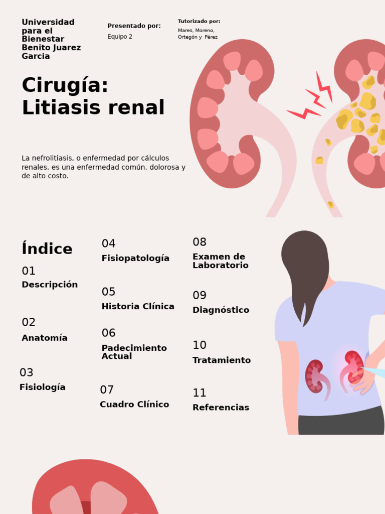 Nefrolitiasis Cirugía | PDF