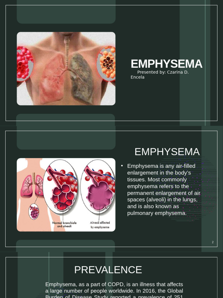 EMPHYSEMA | PDF