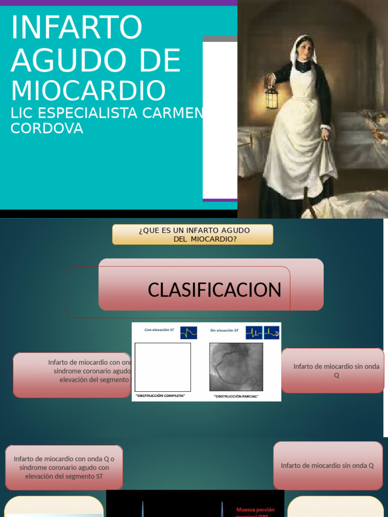 Infarto Agudo de Miocardio: Causas y Tratamiento | PDF | Infarto de ...