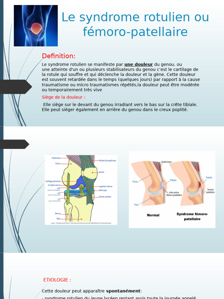Le syndrome rotulien ou fémoro-patellaire | PDF