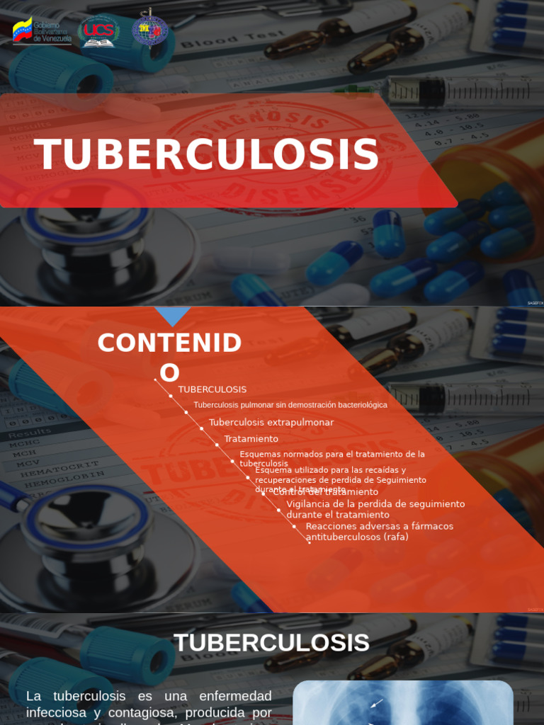 Tuberculosis | PDF