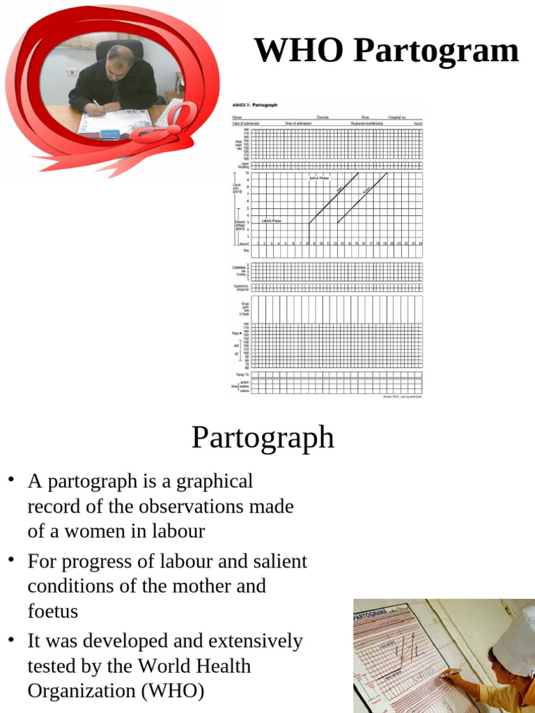 Module 6 C. WHO Partogram For Beginner | PDF