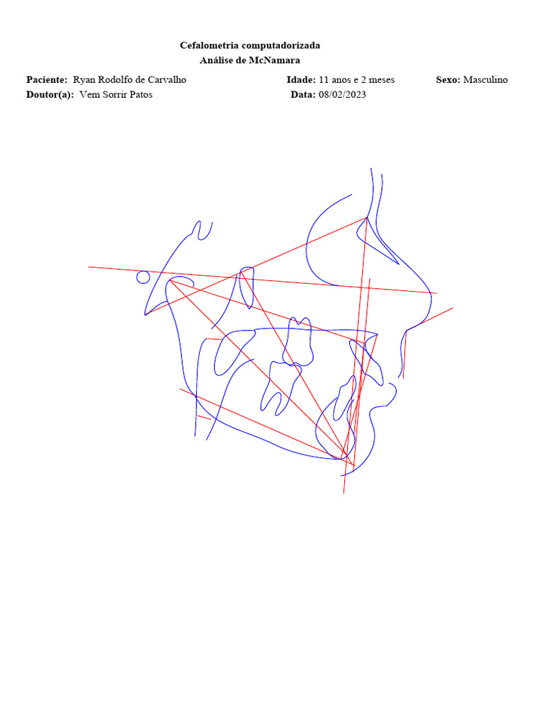 Cefalometria Lateral MC Namara de Ryan Rodolfo de Carvalho | PDF