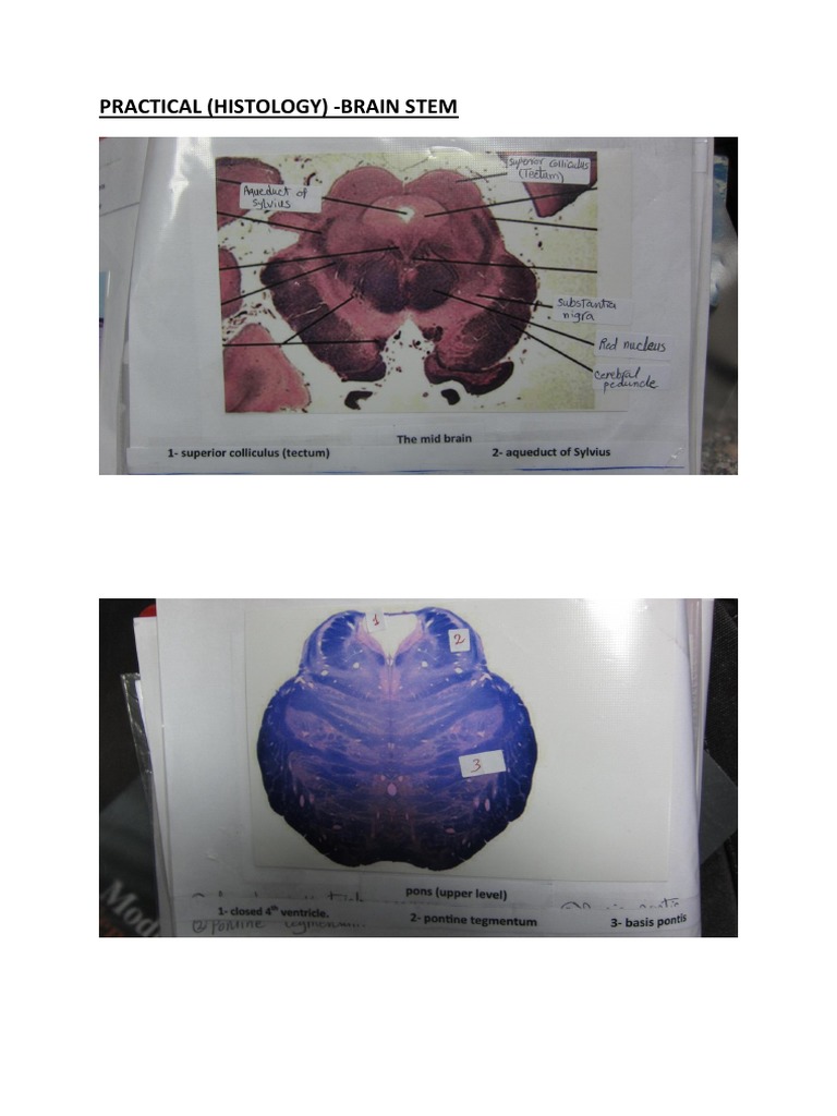 Brain Stem Histology Practical | PDF | Brainstem | Organ (Anatomy)