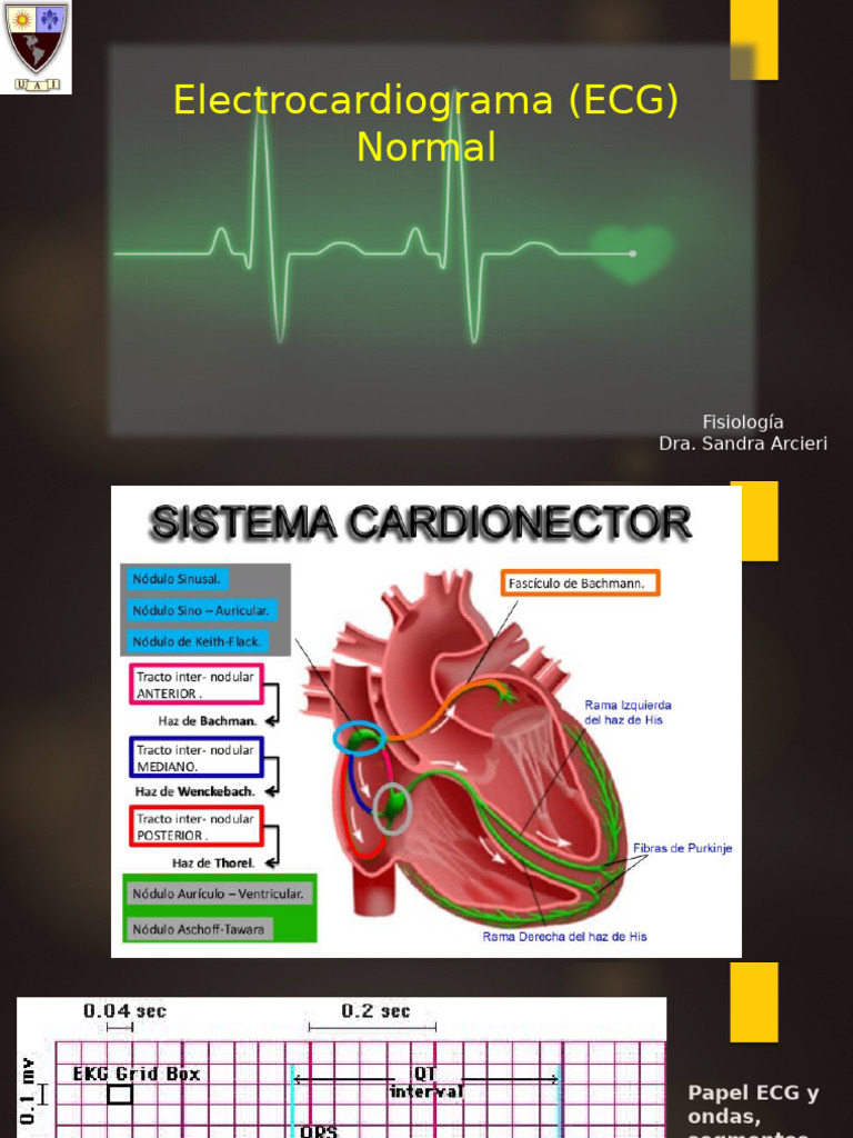ECG - Cardio - Tagged | PDF