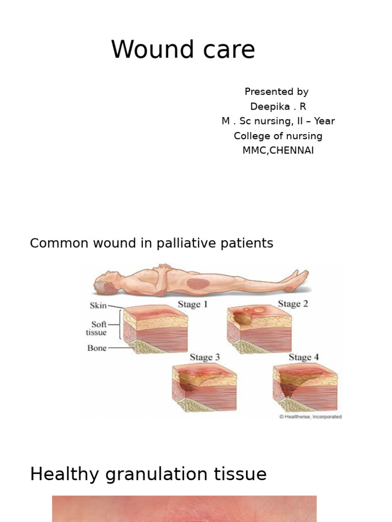 Wound care | PDF