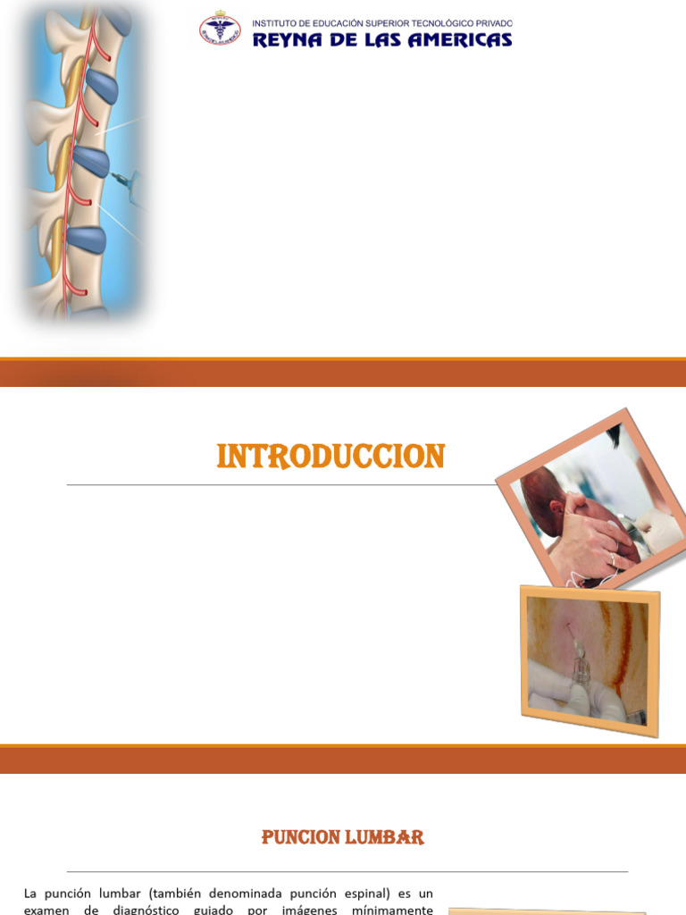 s5. Puncion Lumbar | PDF