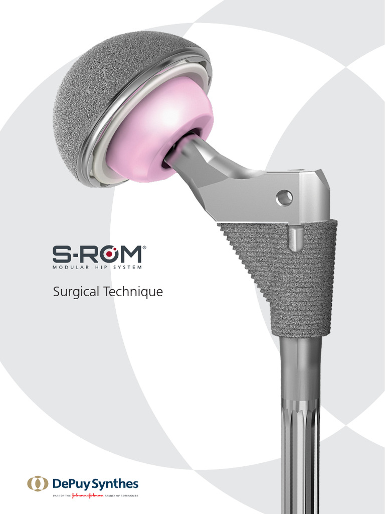 S ROM Surgical Technique 144970200629 | PDF