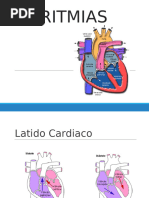Trigeminismo Ventricular: Definición y Tratamiento | PDF