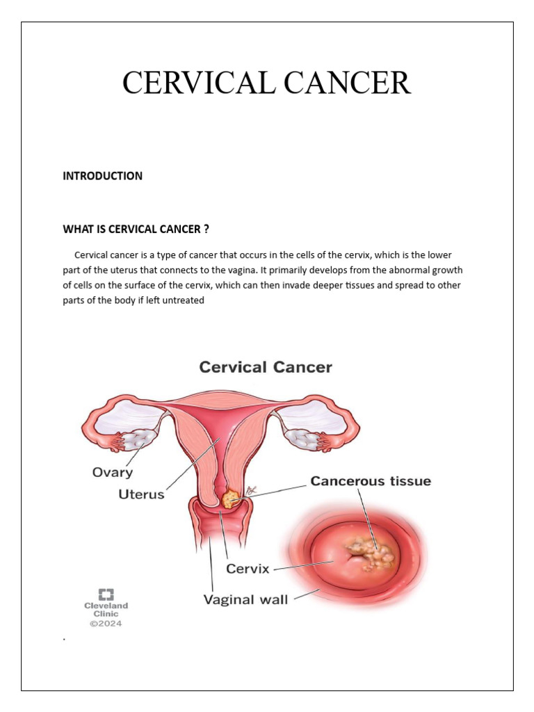 Cervical Cancer | PDF