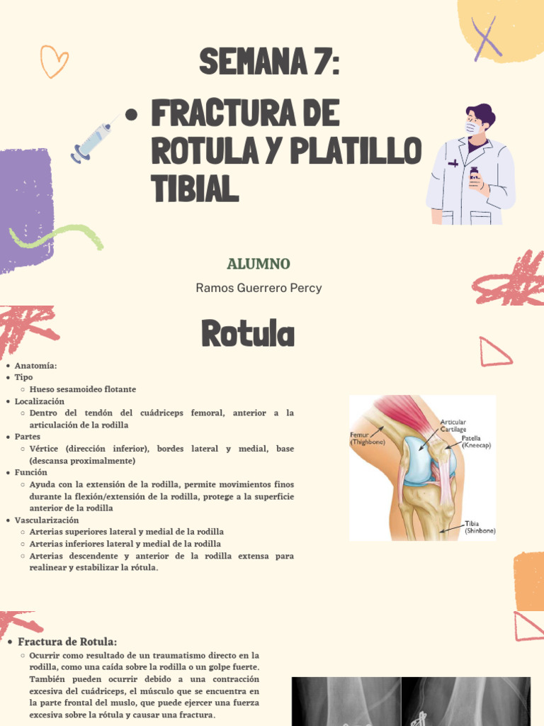 Fractura de Rotula y Platillo Tibial | PDF