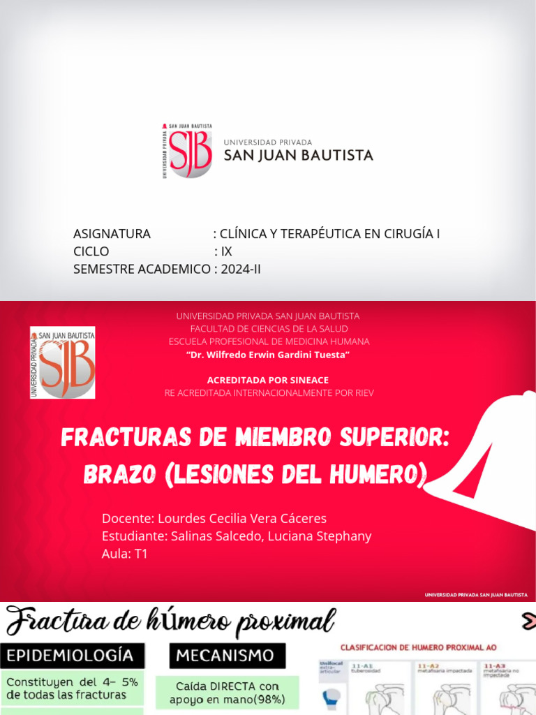 Fractura del húmero | PDF