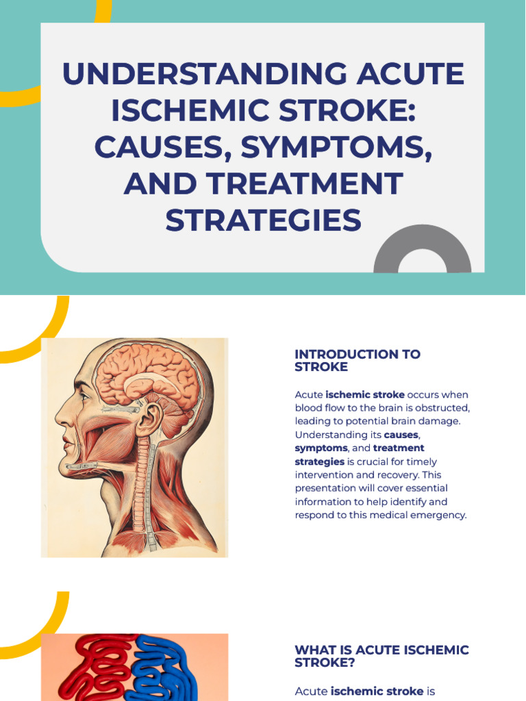 Acute Ischemic Stroke Guide | PDF | Stroke | Thrombosis