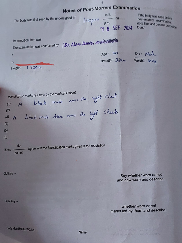 Case 1. Hanging Forensic | PDF | Thrombus | Thrombosis