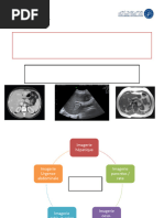 Sémiologie radiologique du syndrome bronchique | PDF | Poumon ...